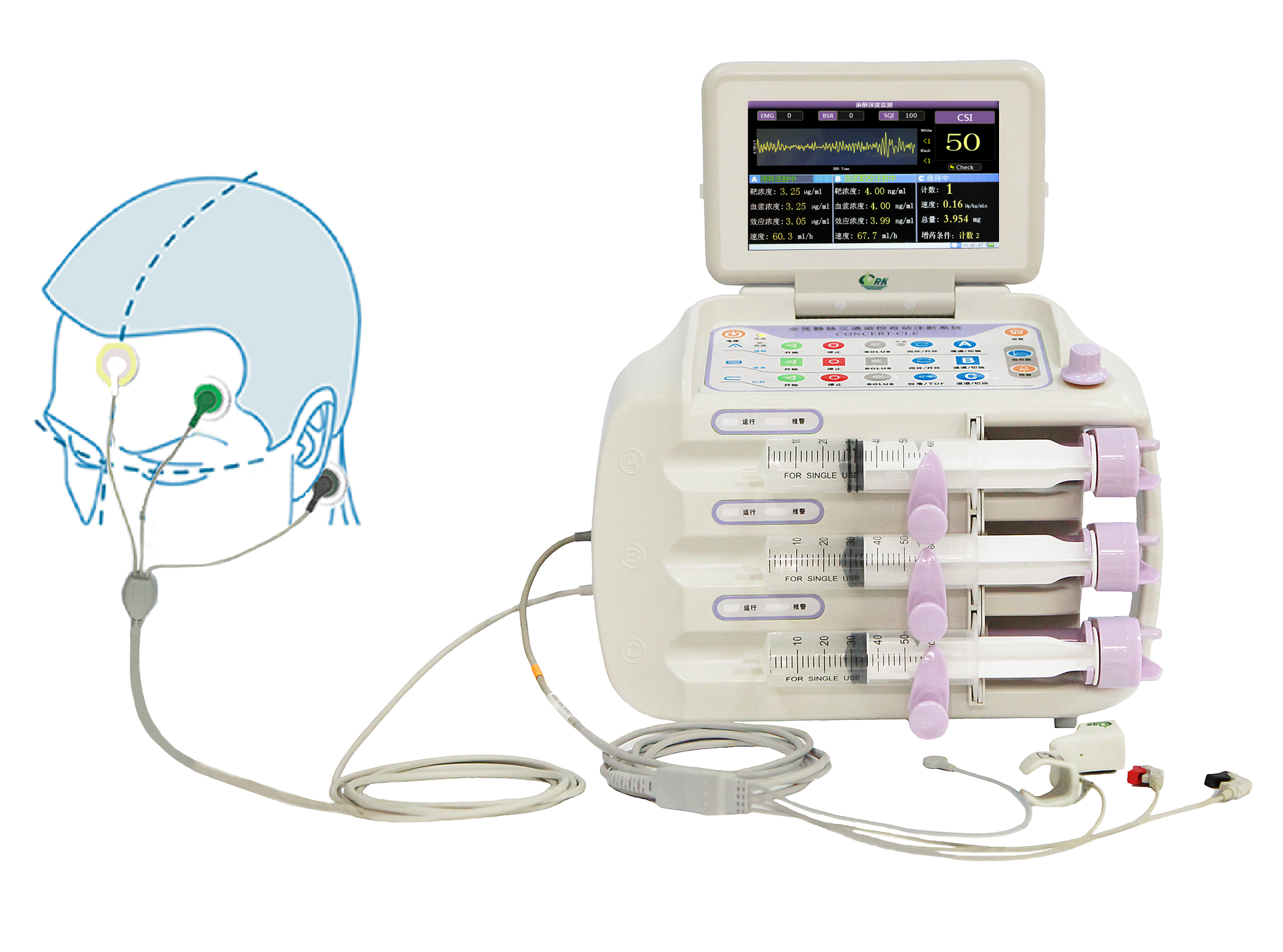 EEG Monitor Integrated Closed-Loop Infusion System